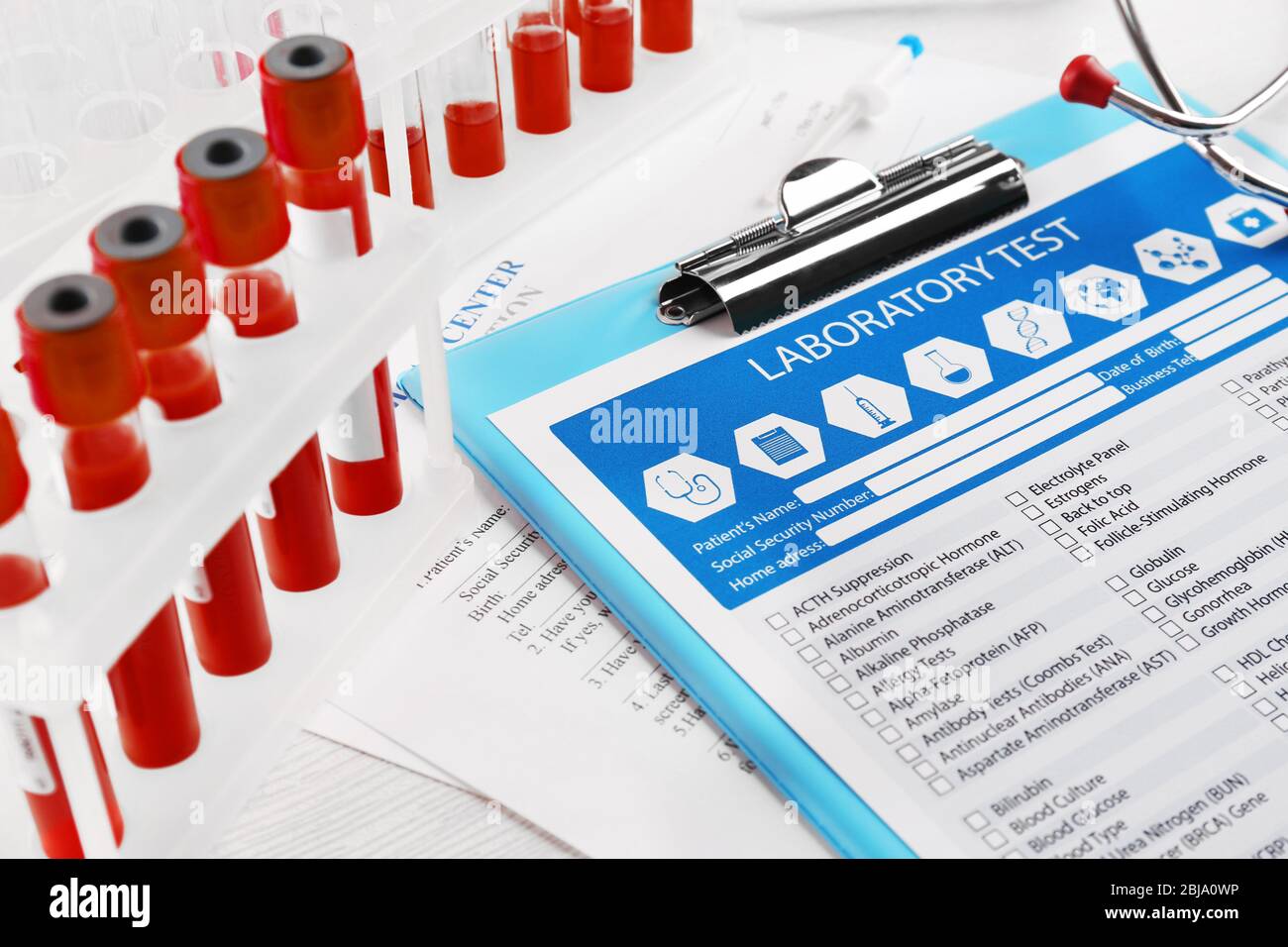 Blood samples with laboratory test Stock Photo - Alamy