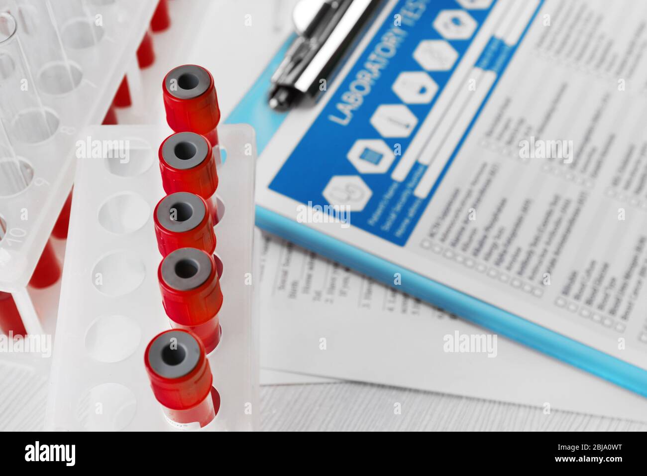 Blood samples with laboratory test Stock Photo - Alamy