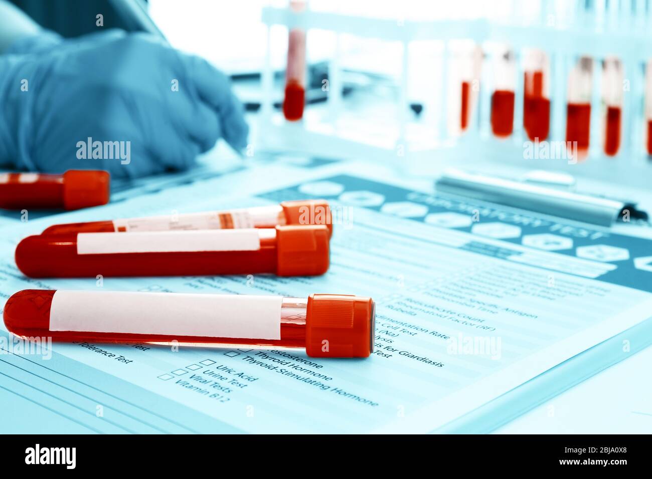 Blood samples and doctor hands on medical report Stock Photo - Alamy