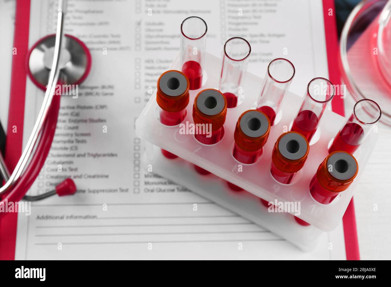 Blood samples and stethoscope on medical report Stock Photo - Alamy