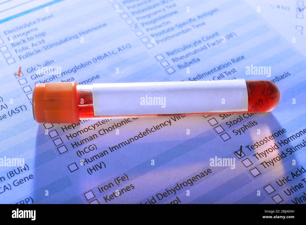 Blood sample on medical report Stock Photo - Alamy