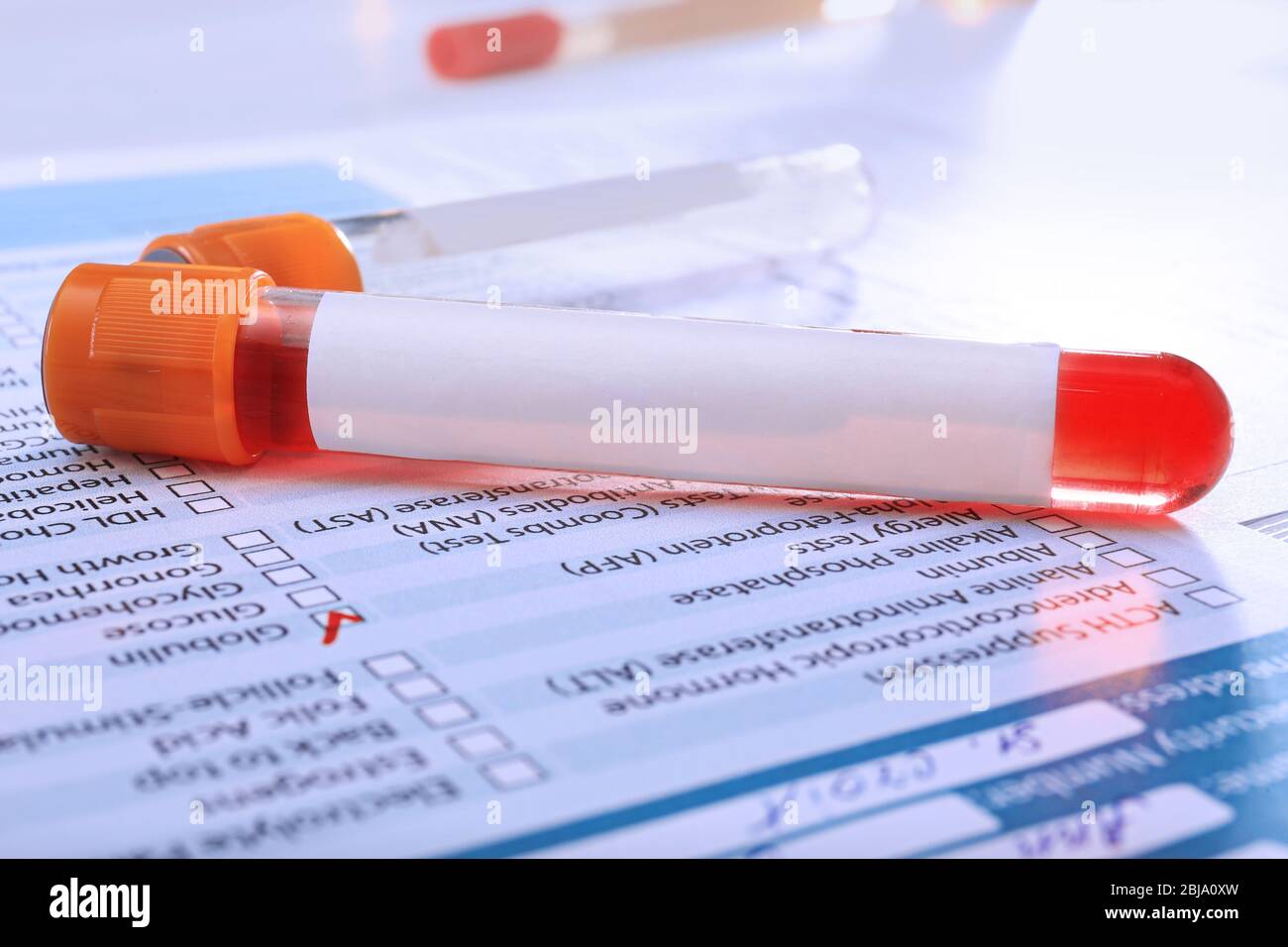 Blood samples on tray hi-res stock photography and images - Alamy