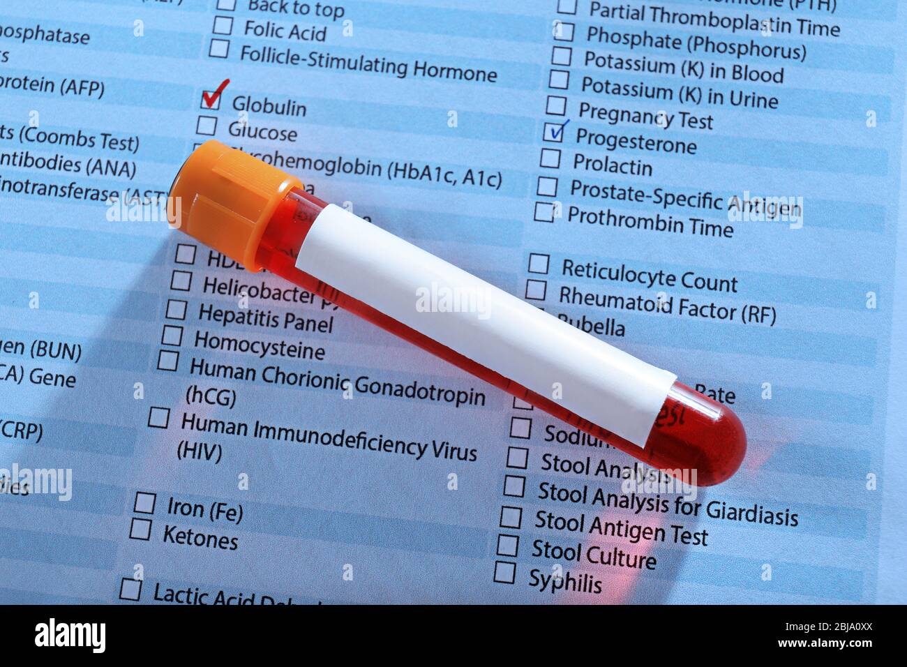 Blood sample on medical report Stock Photo - Alamy