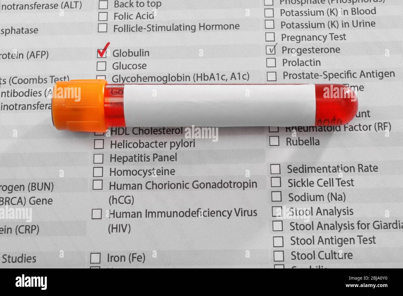 Blood sample on medical report Stock Photo - Alamy