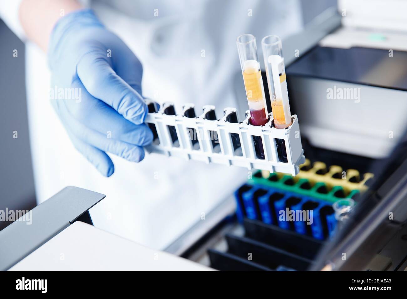 Nurse microbiologist holding test tube with blood for coronavirus 2019 ...