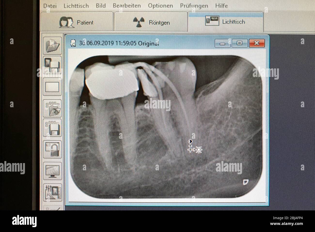 Dentist x rays hi-res stock photography and images - Alamy