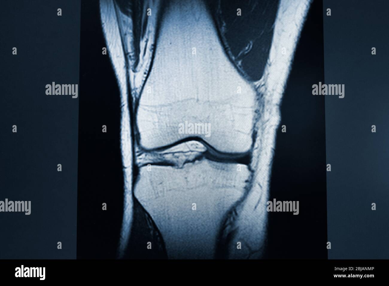 Transparent arthritis hi-res stock photography and images - Alamy