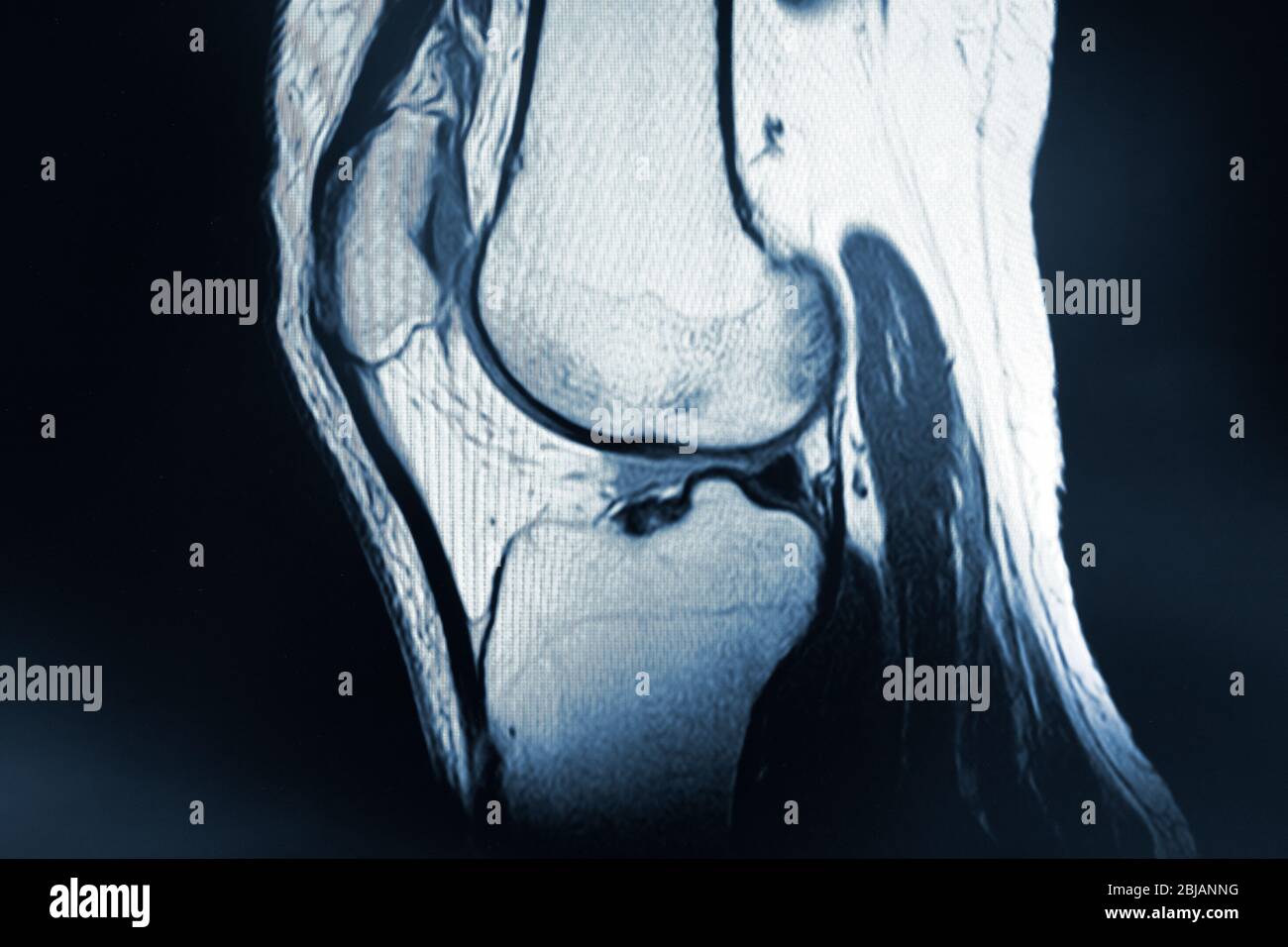 Transparent arthritis hi-res stock photography and images - Alamy