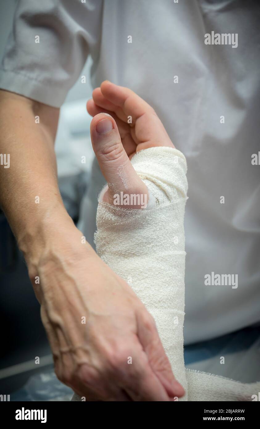 Wrist plaster hi-res stock photography and images - Alamy