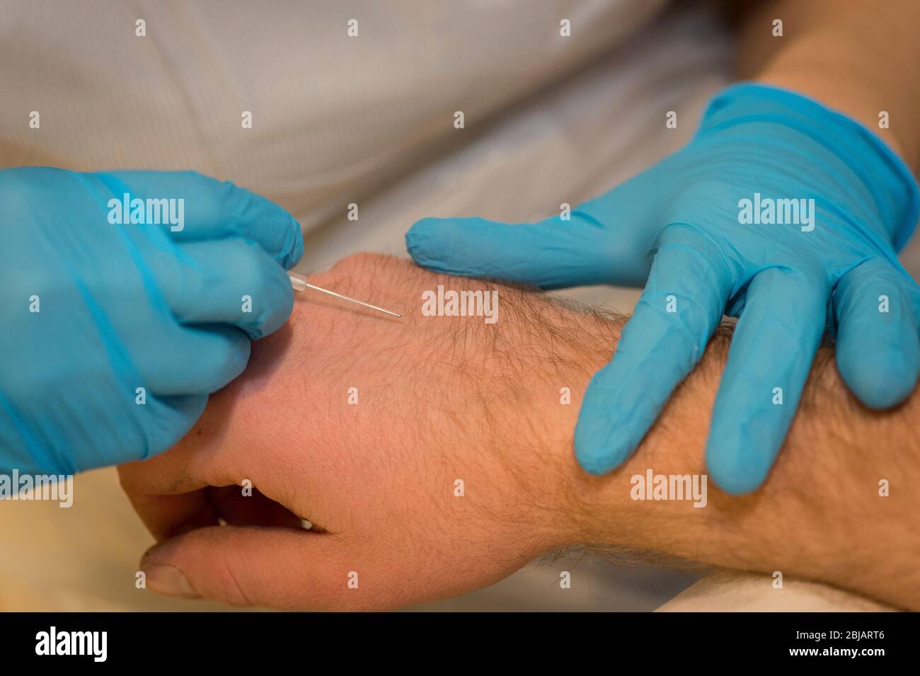 Medical worker about to insert a cannula into a patient's hand Stock ...