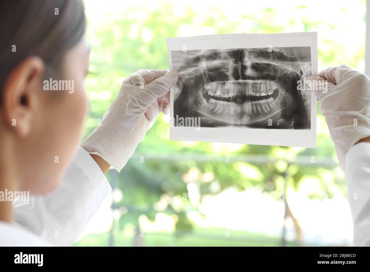 Roentgenography hi-res stock photography and images - Alamy