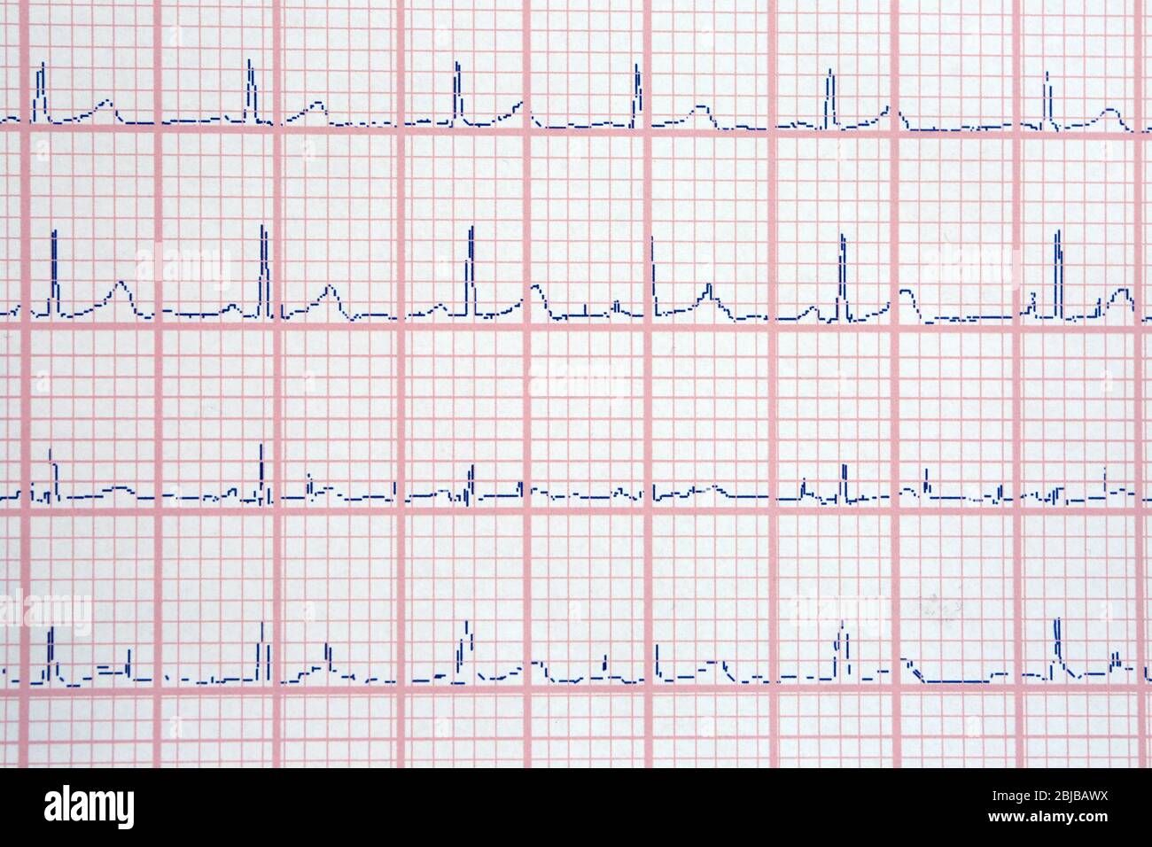 Electrocardiogram in paper form, closeup Stock Photo - Alamy