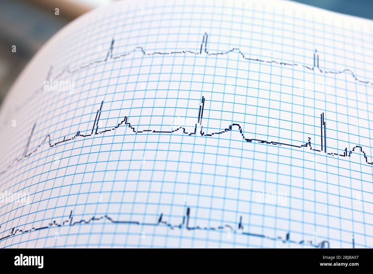 Electrocardiogram in paper form, closeup Stock Photo - Alamy