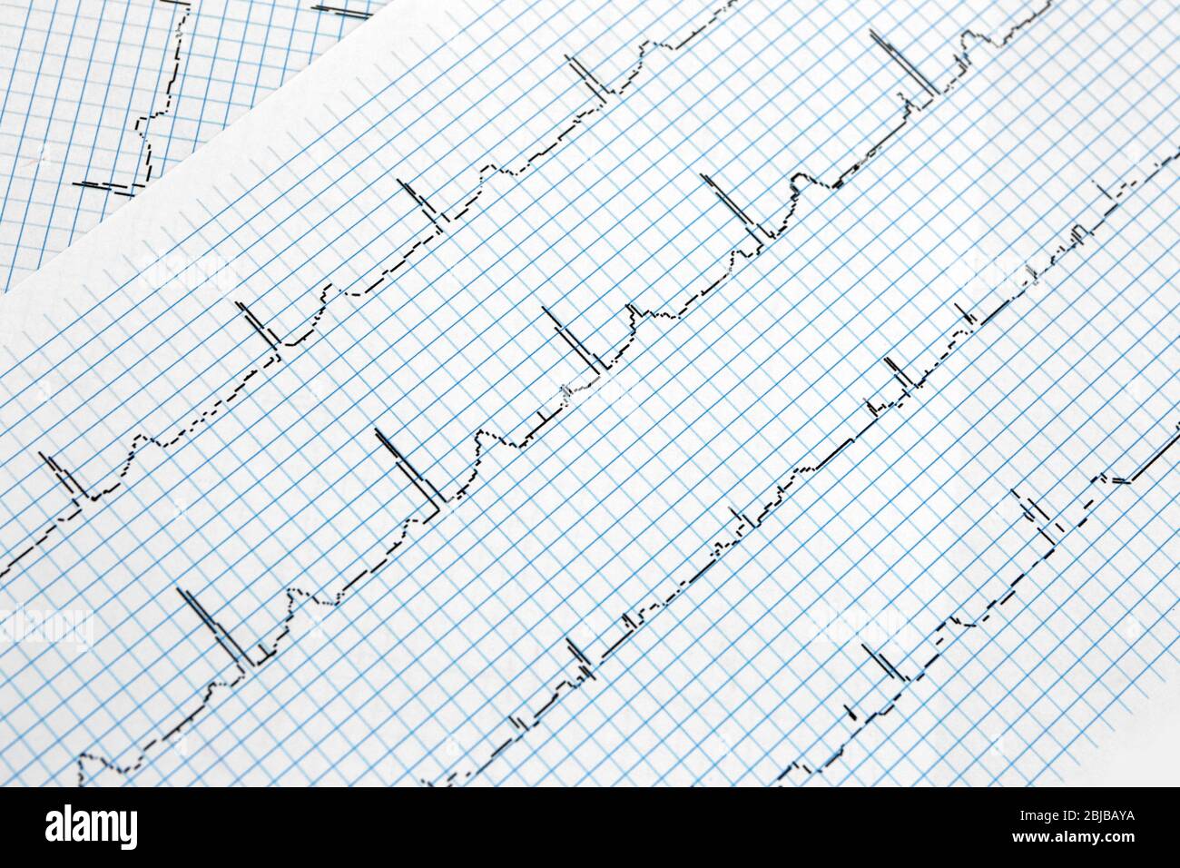 Electrocardiogram in paper form, closeup Stock Photo - Alamy