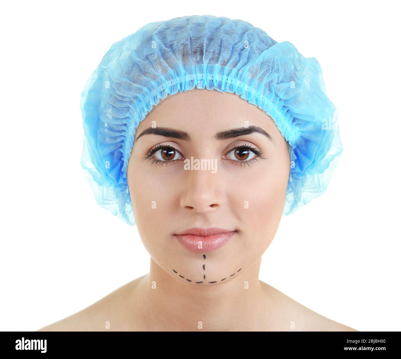 Plastic surgery concept. Portrait of beautiful woman with marking on ...