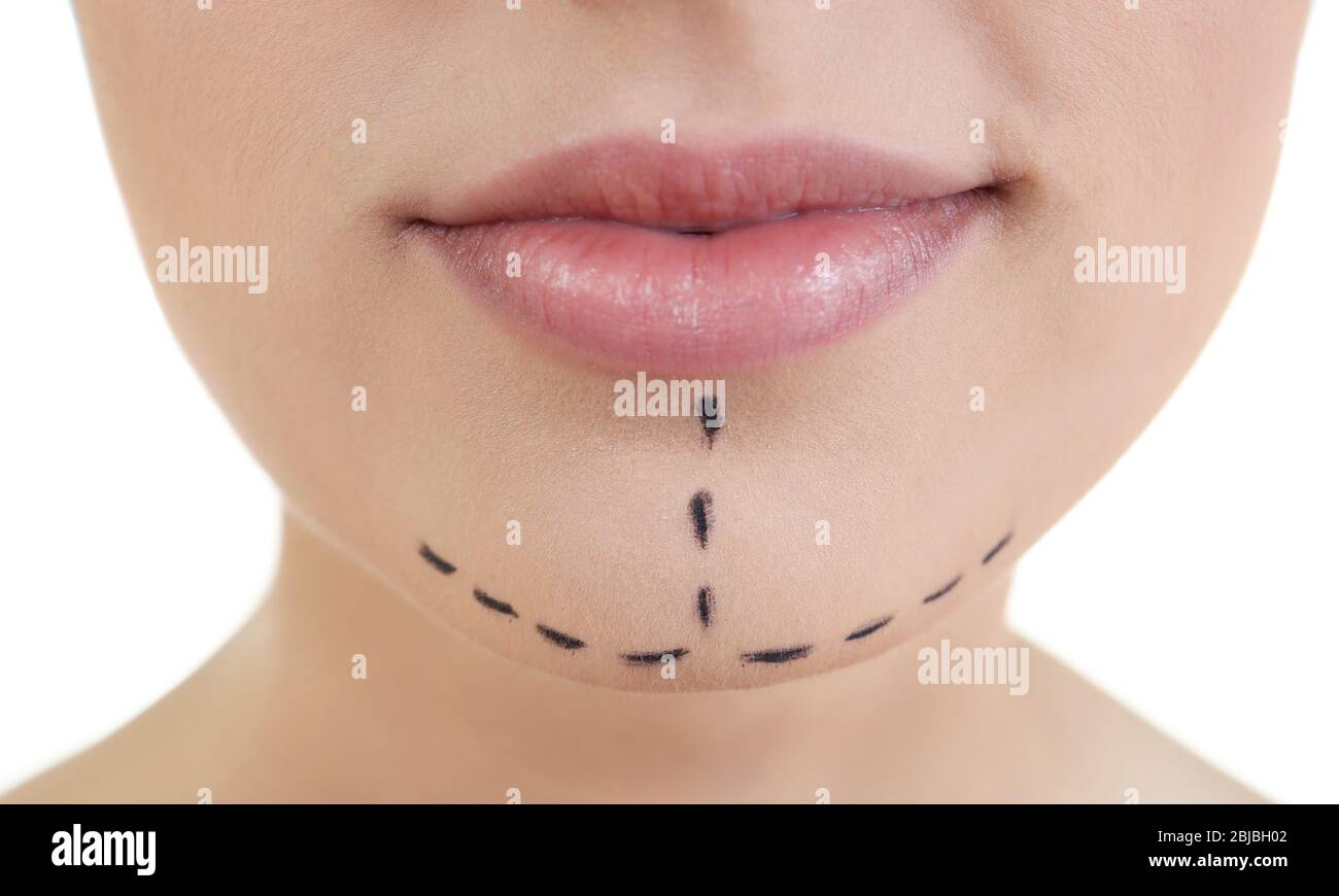 Plastic surgery concept. Portrait of beautiful woman with marking on ...