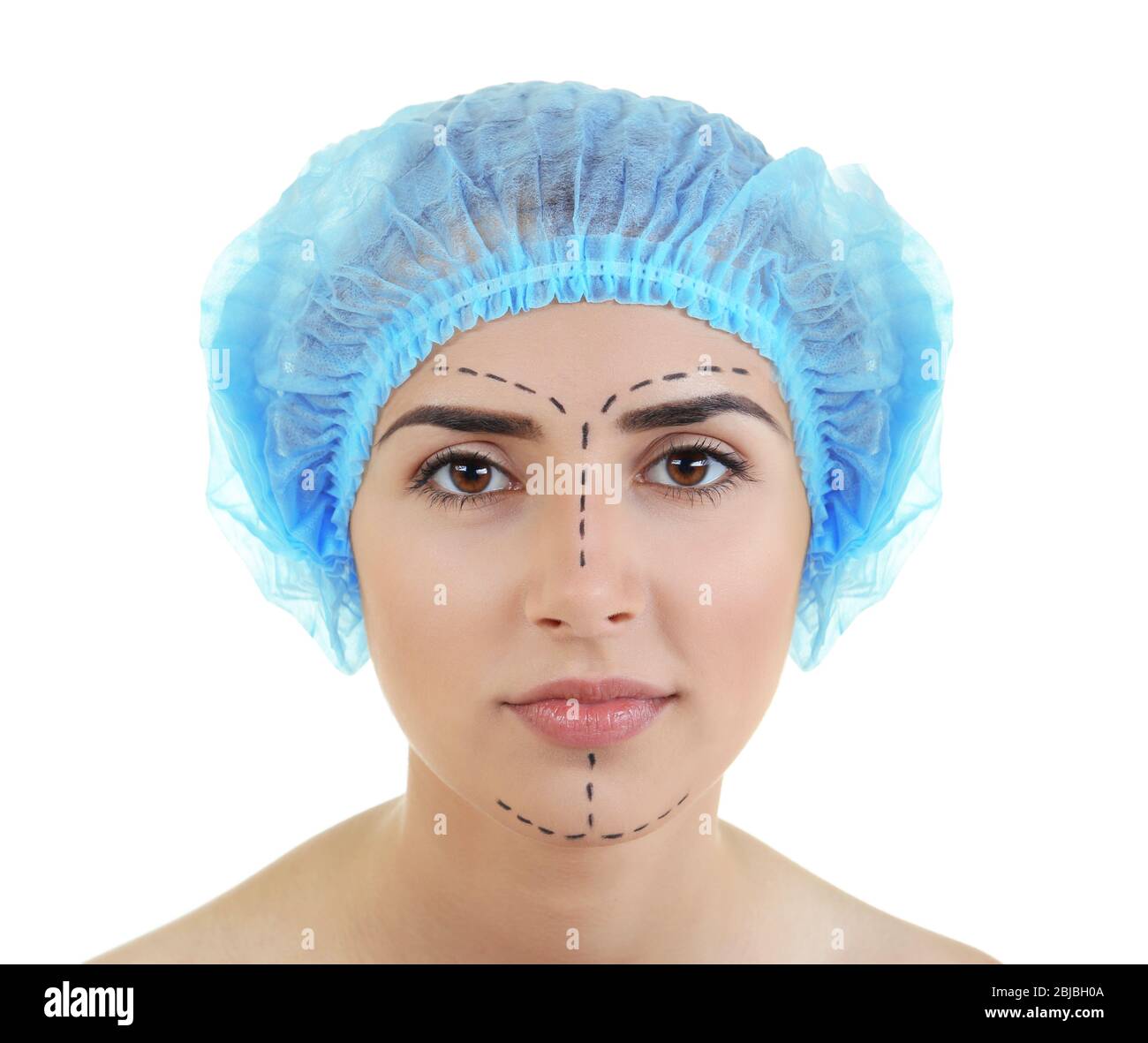 Plastic surgery concept. Portrait of beautiful woman with marking on ...