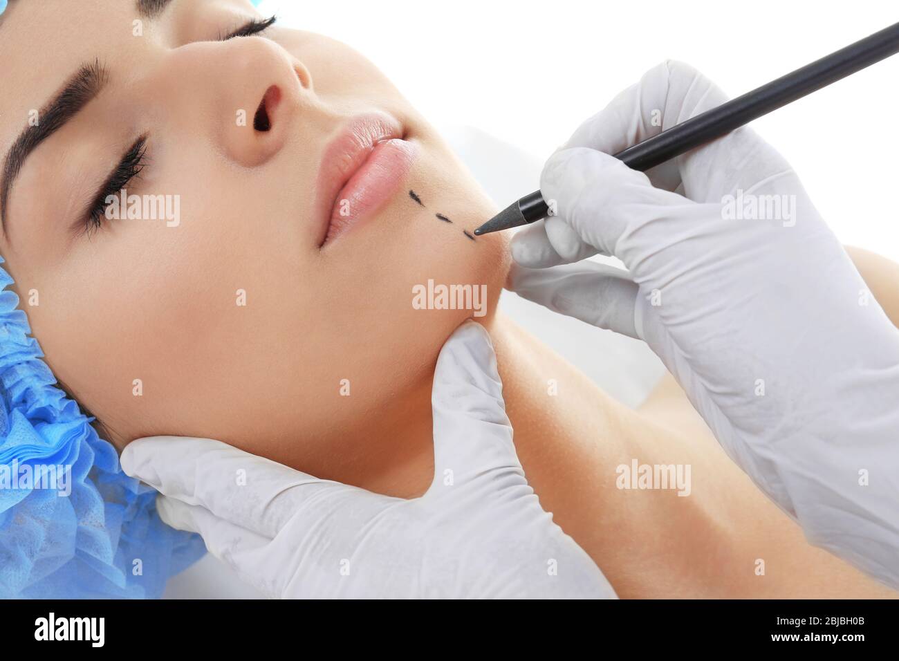 Plastic surgery concept. Hands in gloves marking women face Stock Photo ...