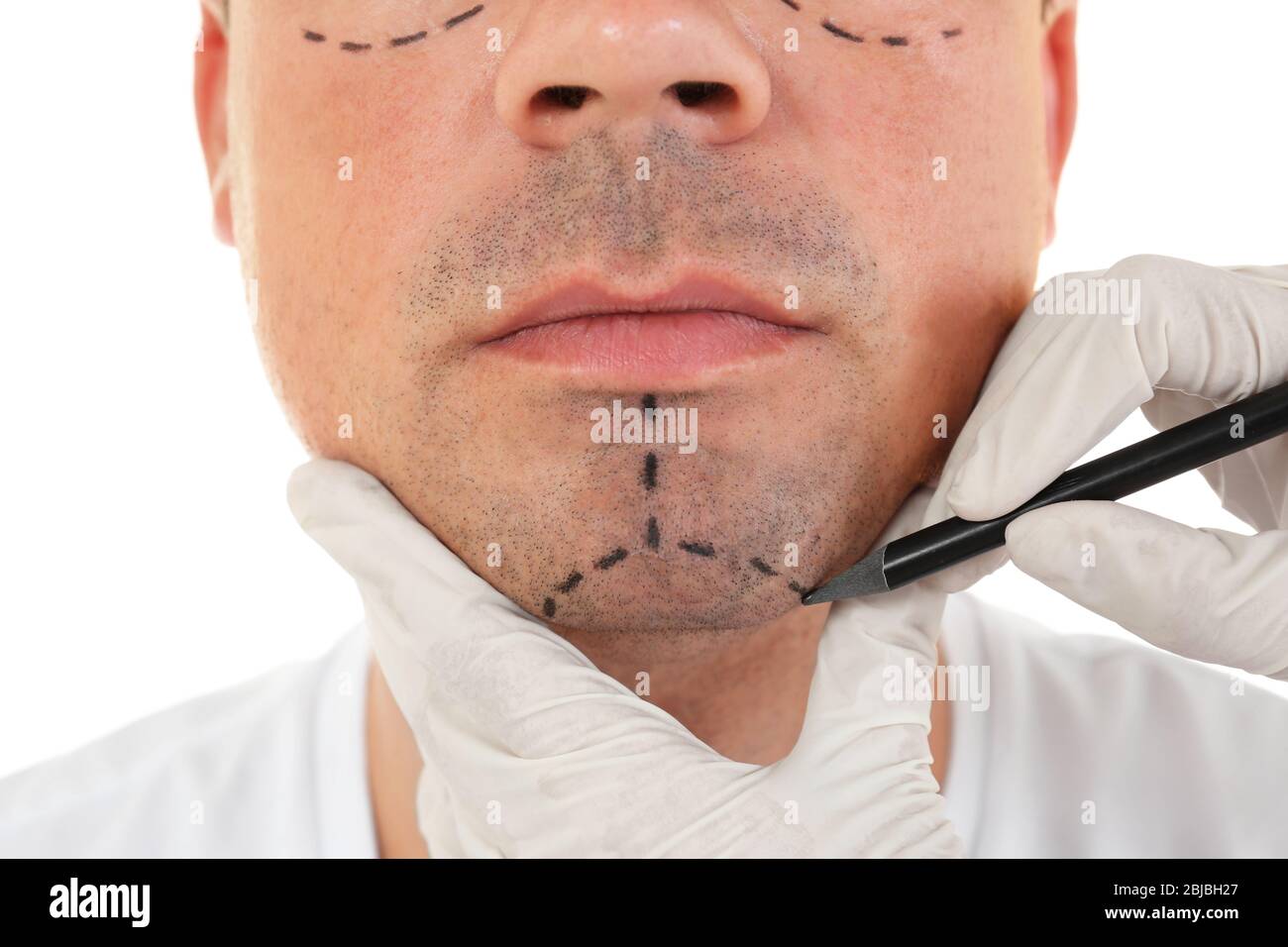 Plastic surgery concept. Hands in gloves marking male face Stock Photo ...