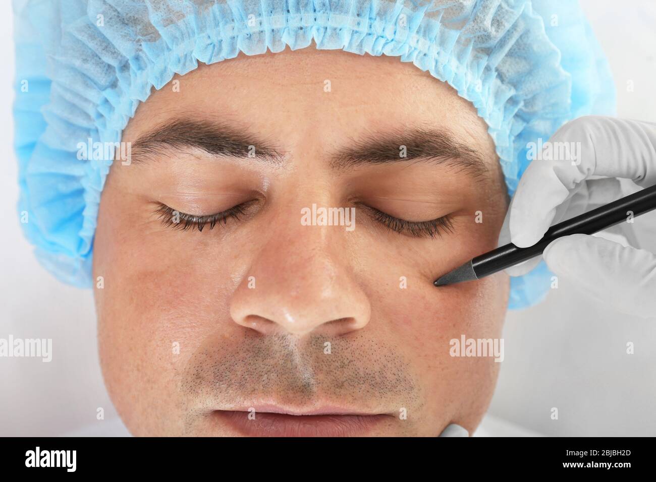 Plastic surgery concept. Hand in glove marking male face Stock Photo ...