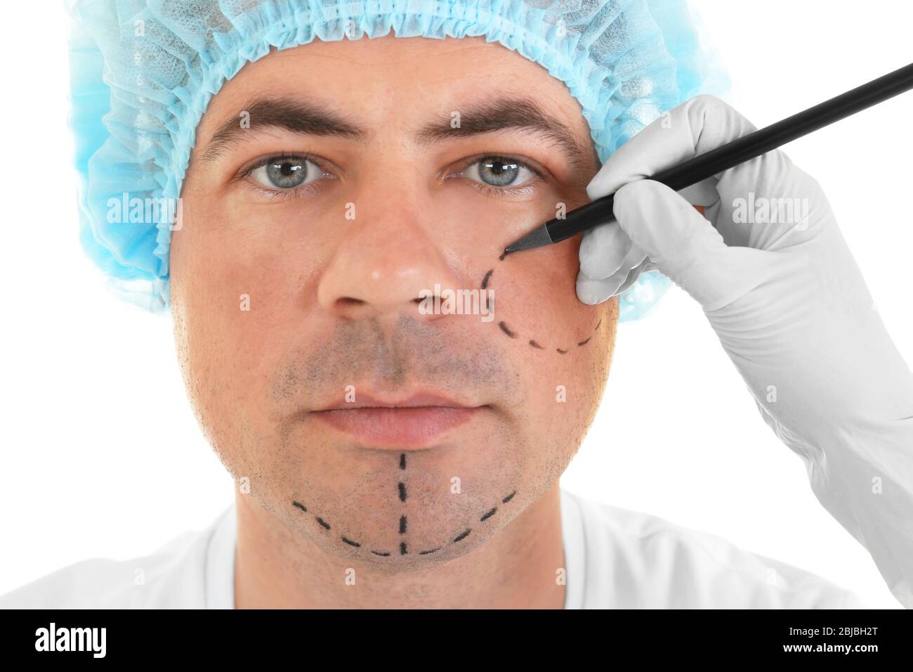 Plastic surgery concept. Hand in glove marking male face Stock Photo ...