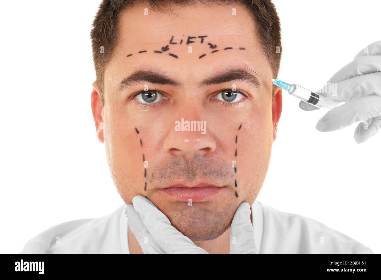 Plastic surgery concept. Hyaluronic acid injection Stock Photo - Alamy