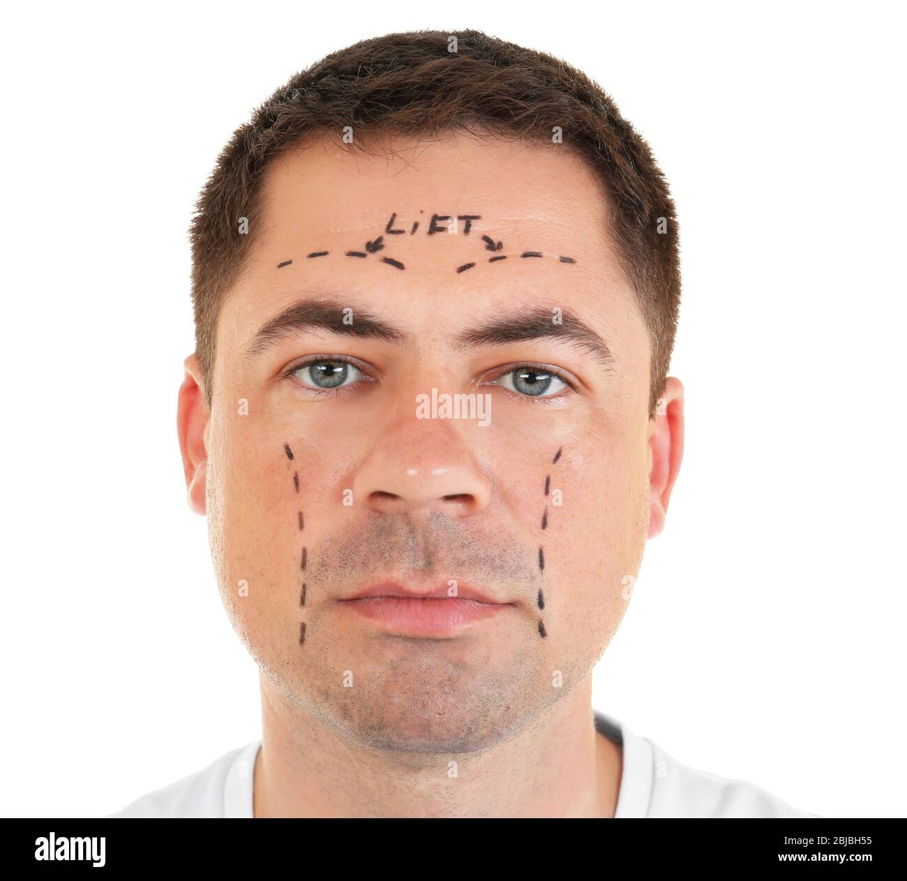 Plastic surgery concept. Portrait of handsome man with marking on face ...