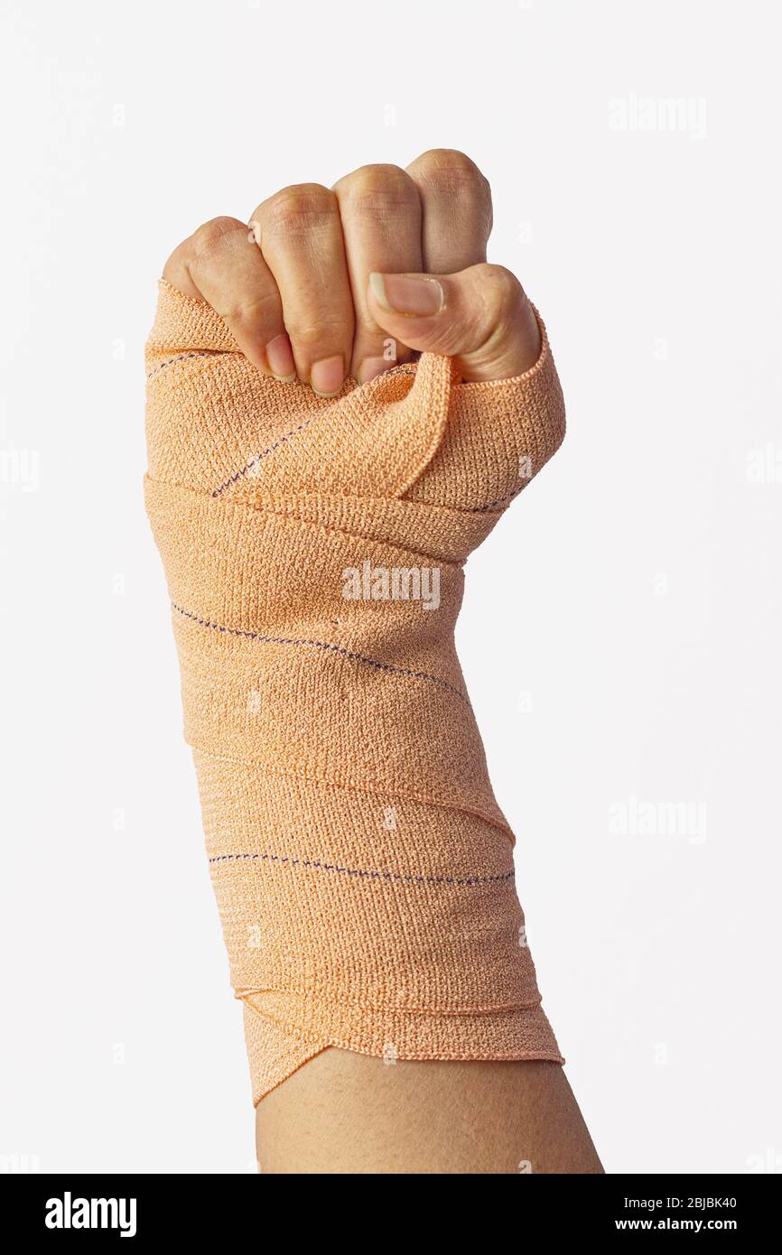 Bone fracture first aid hi-res stock photography and images - Alamy