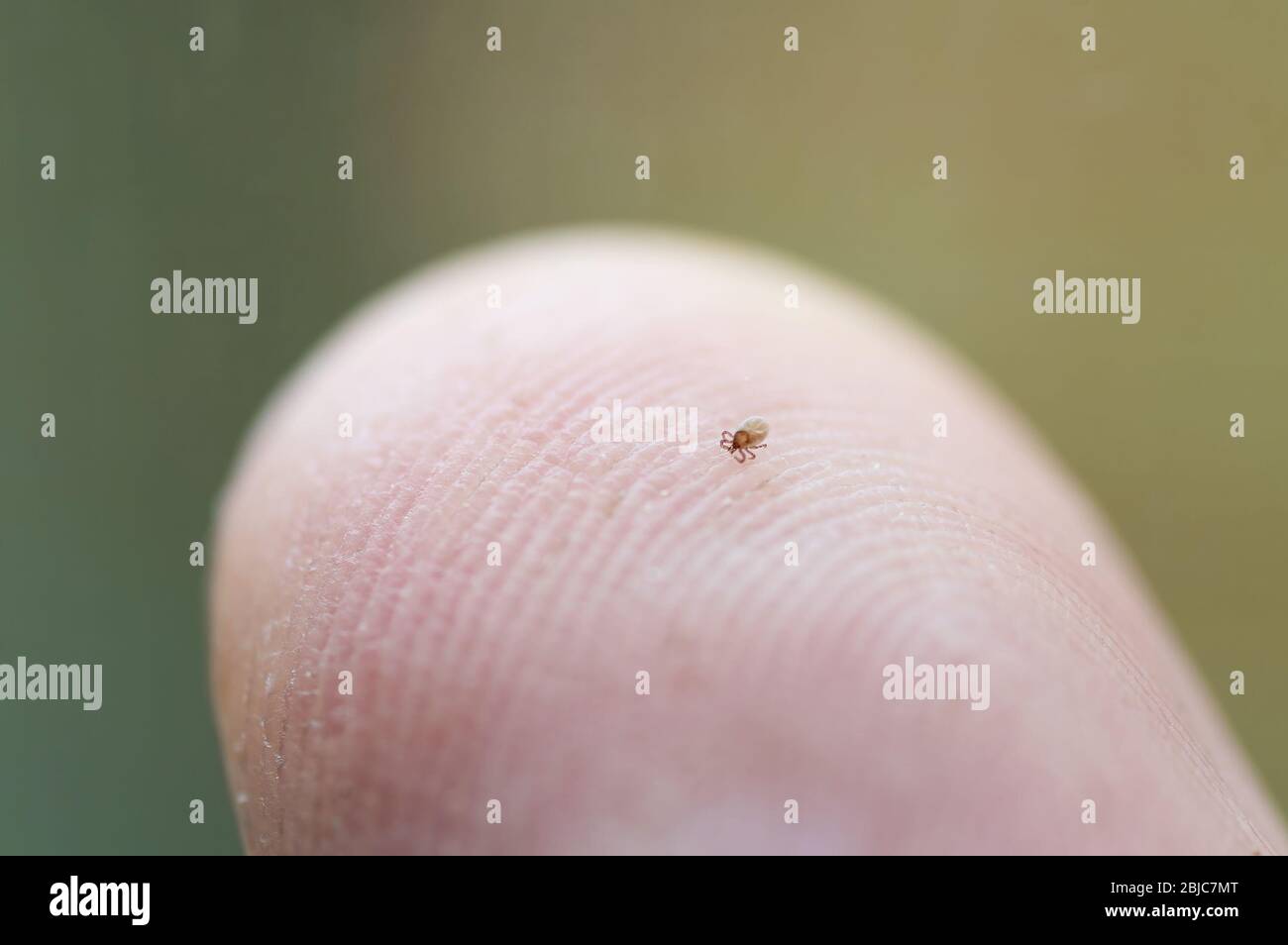 Parasitism In Humans