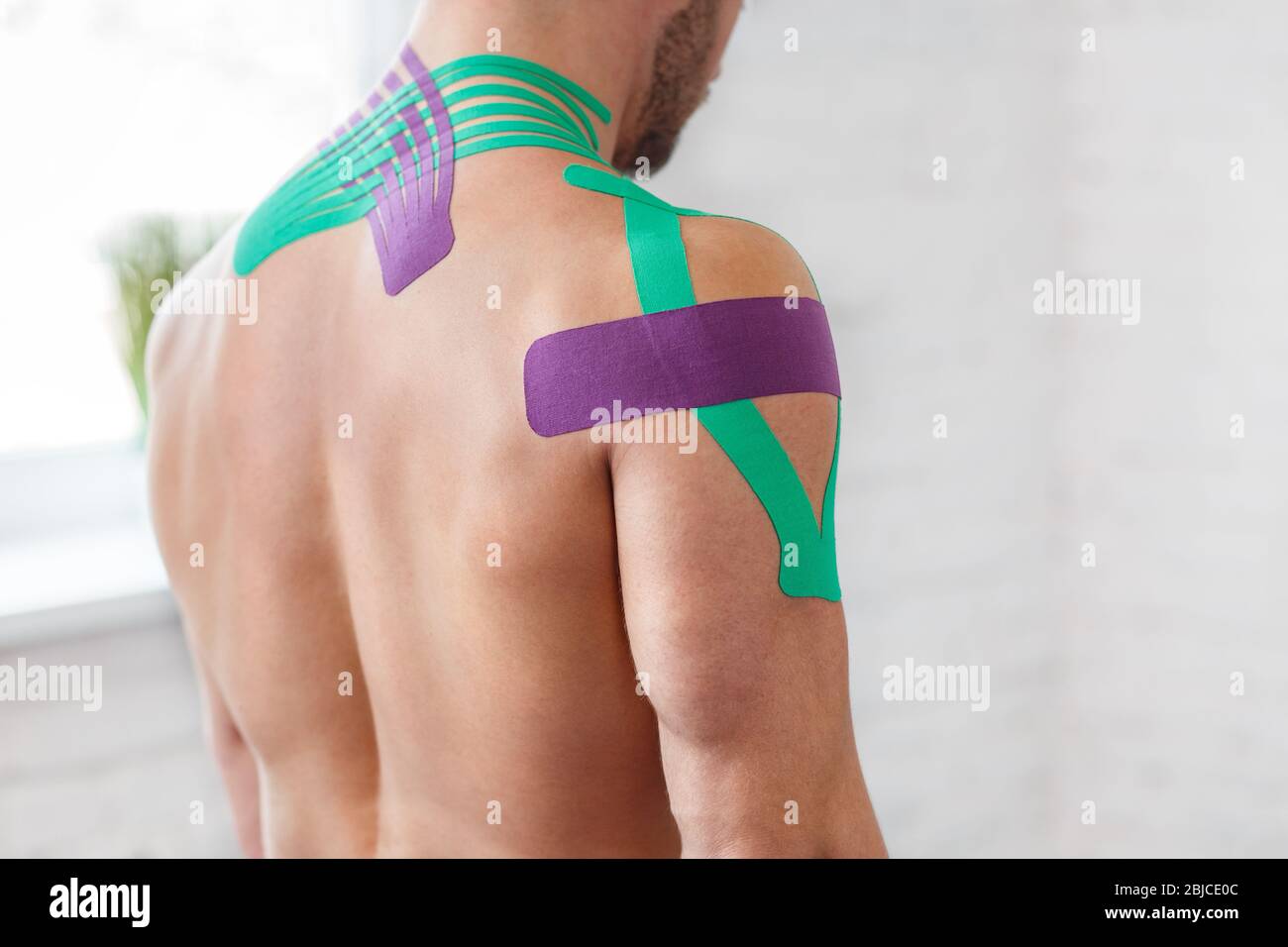 Kinesiology taping. Kinesiology tape on patient neck. Injured trapezius muscles treatment of ...