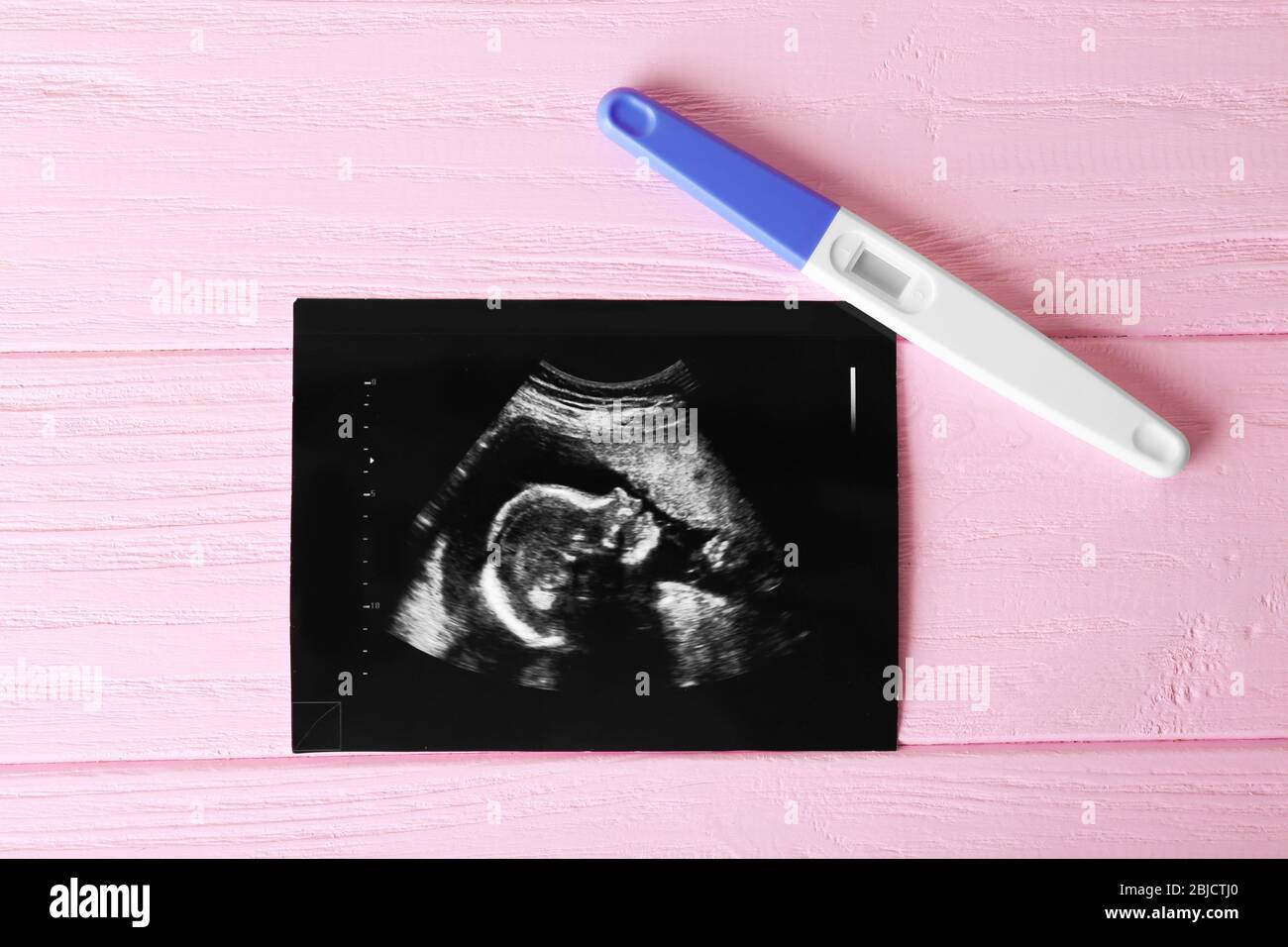 Ultrasound photo and pregnancy test on pink wooden background Stock ...