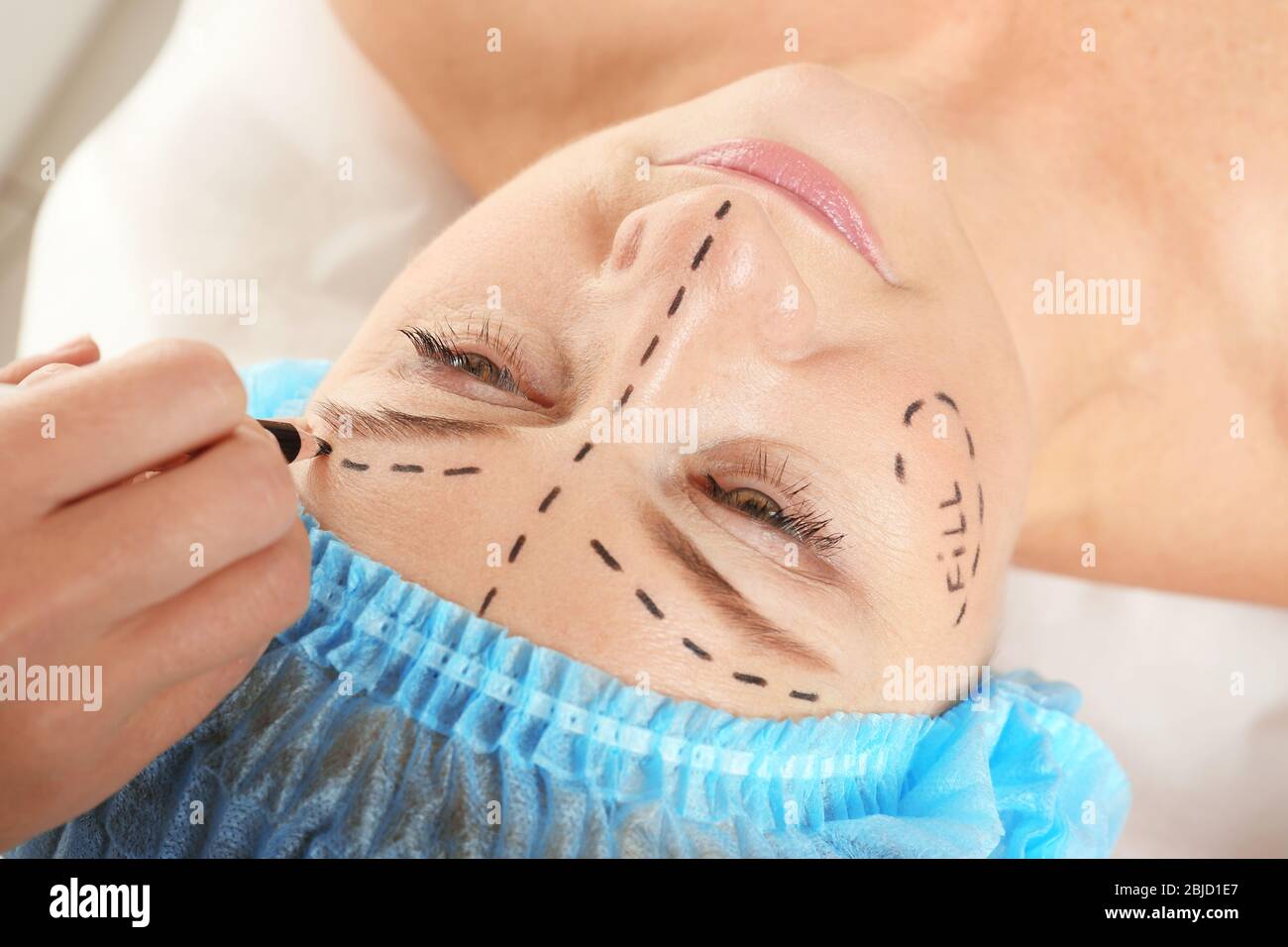 Surgeon hand drawing marks on female face for plastic operation Stock ...