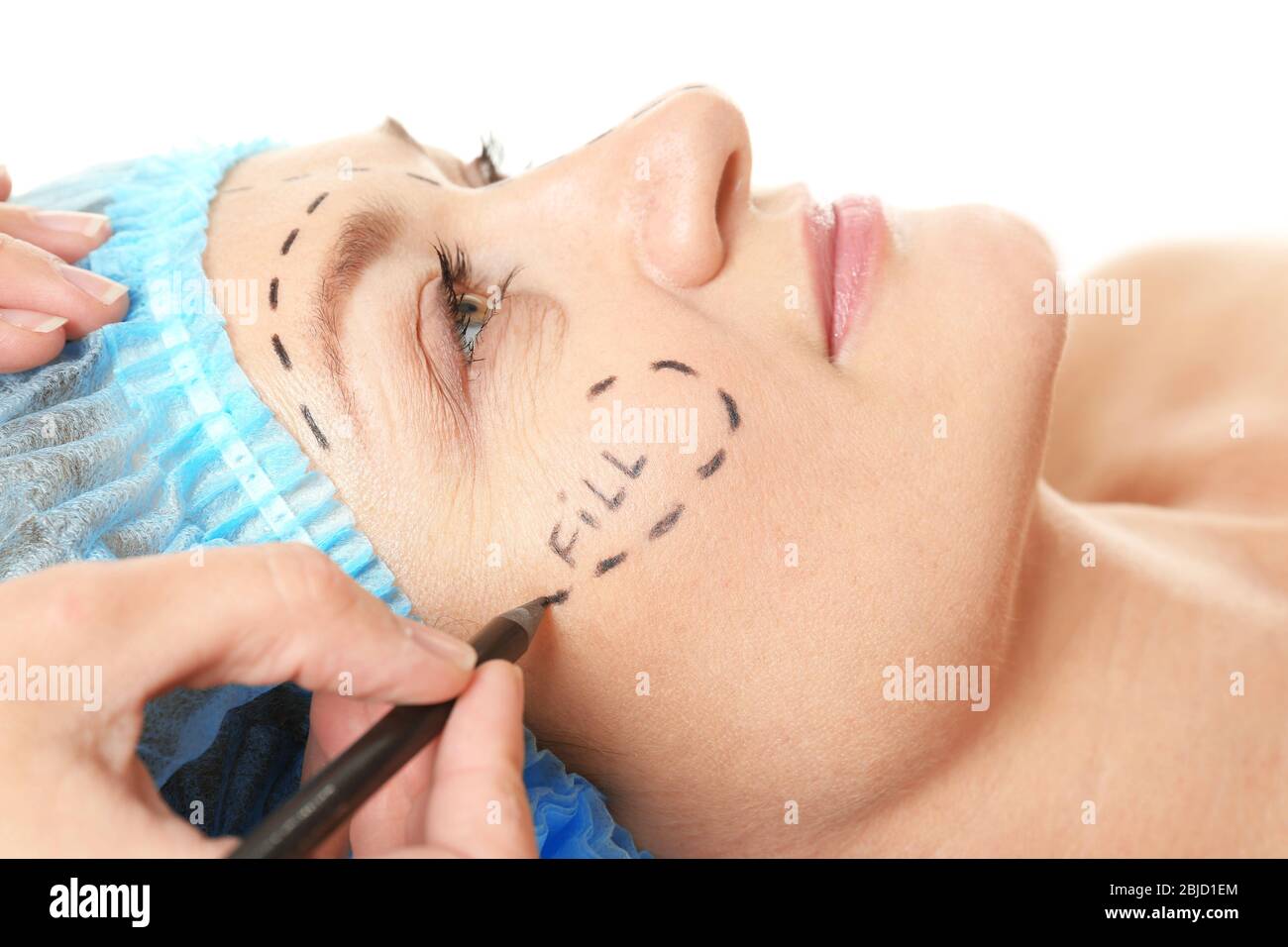 Surgeon hands drawing marks on female face for plastic operation Stock ...