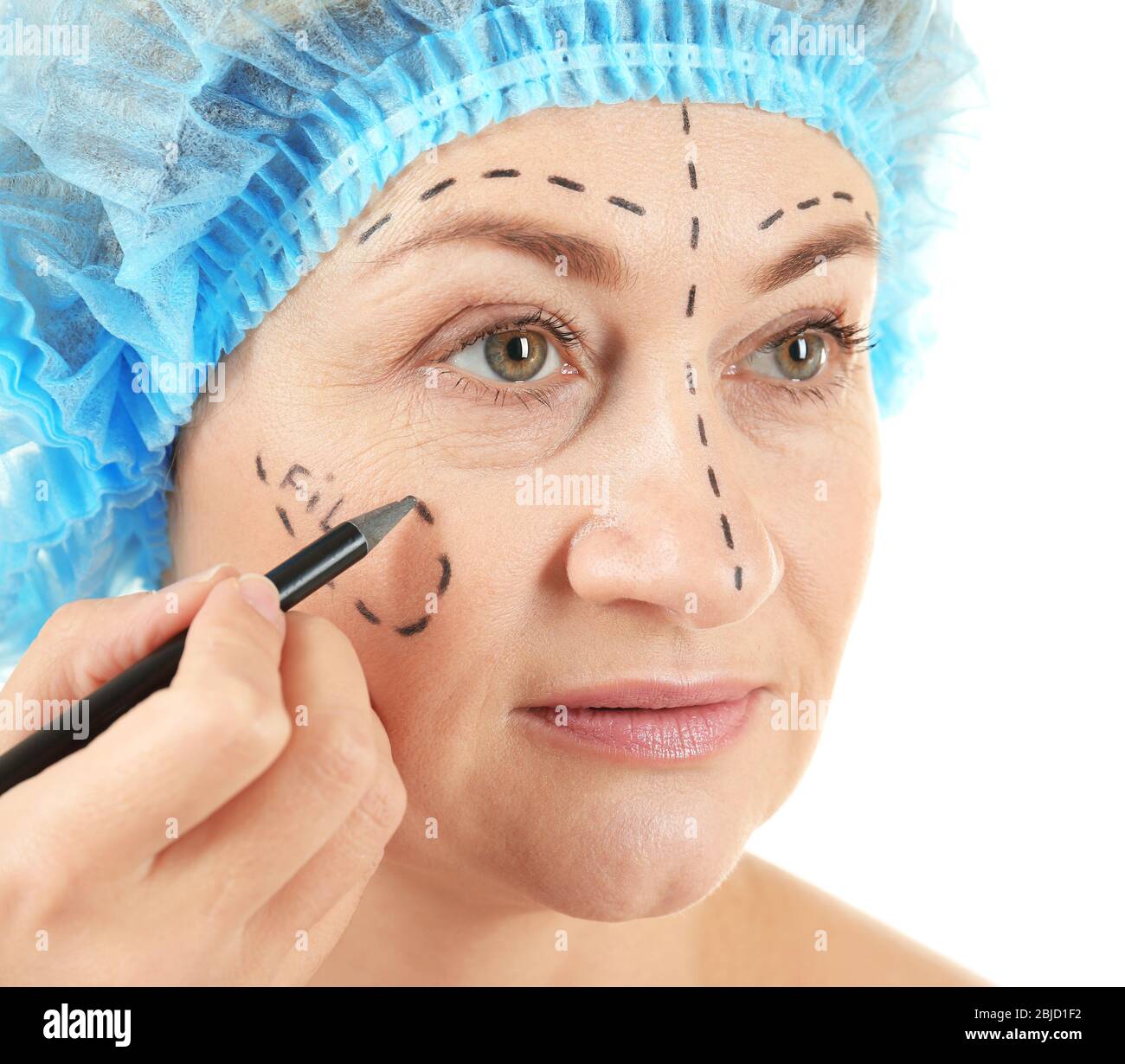 Surgeon hand drawing marks on female face for plastic operation Stock ...