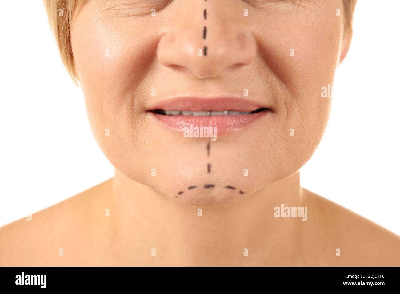 Woman with marks on face for plastic operation Stock Photo - Alamy