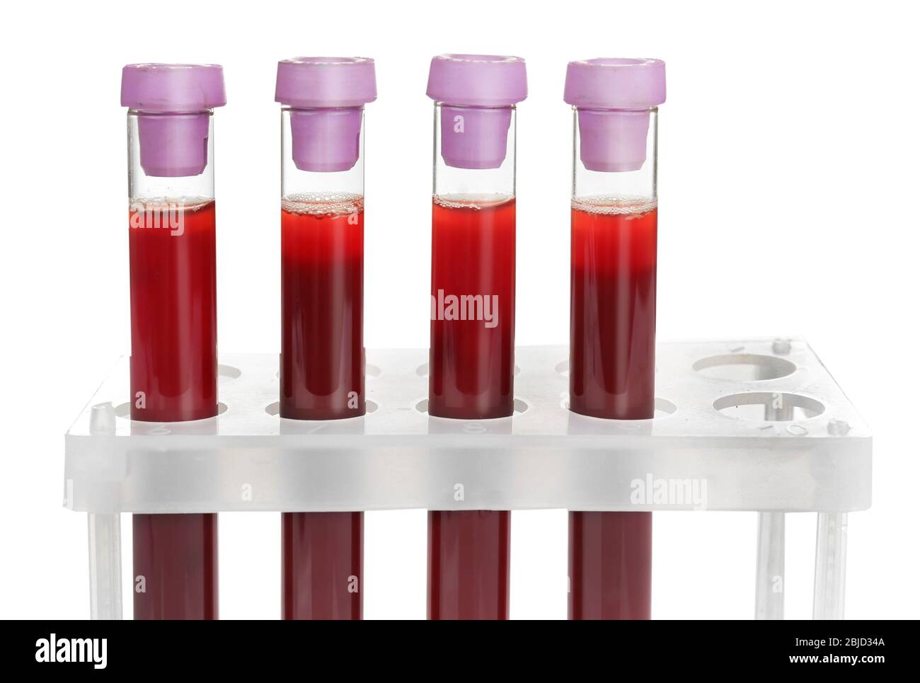 Test tubes with blood isolated on white Stock Photo - Alamy