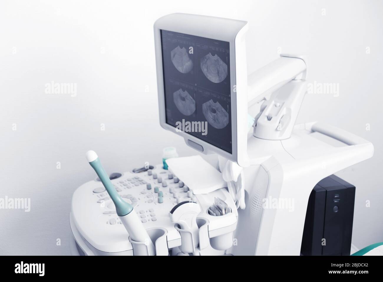 Early pregnancy ultrasound hi-res stock photography and images - Alamy