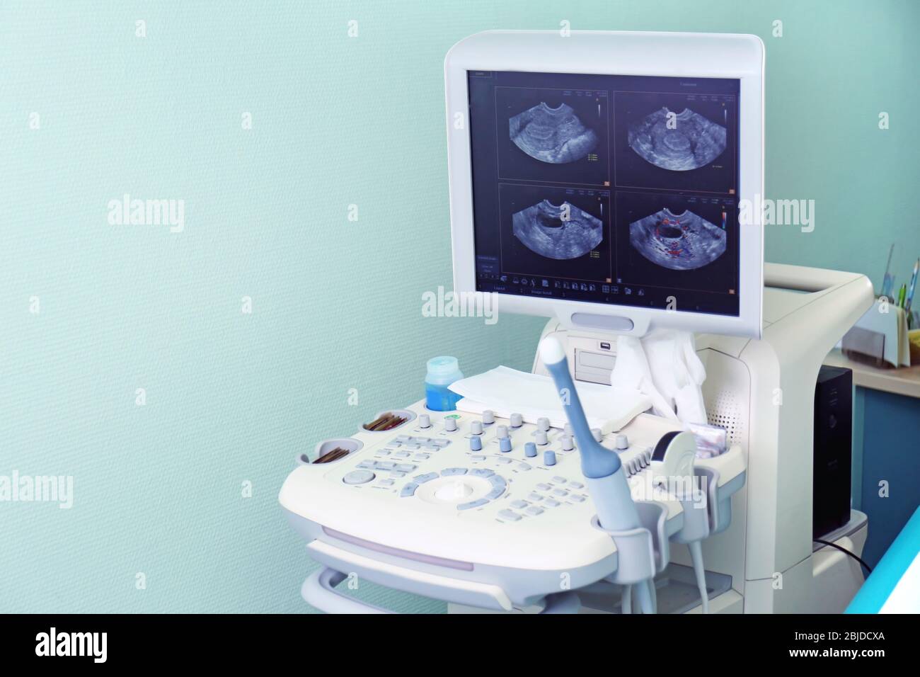 Early pregnancy ultrasound hi-res stock photography and images - Alamy