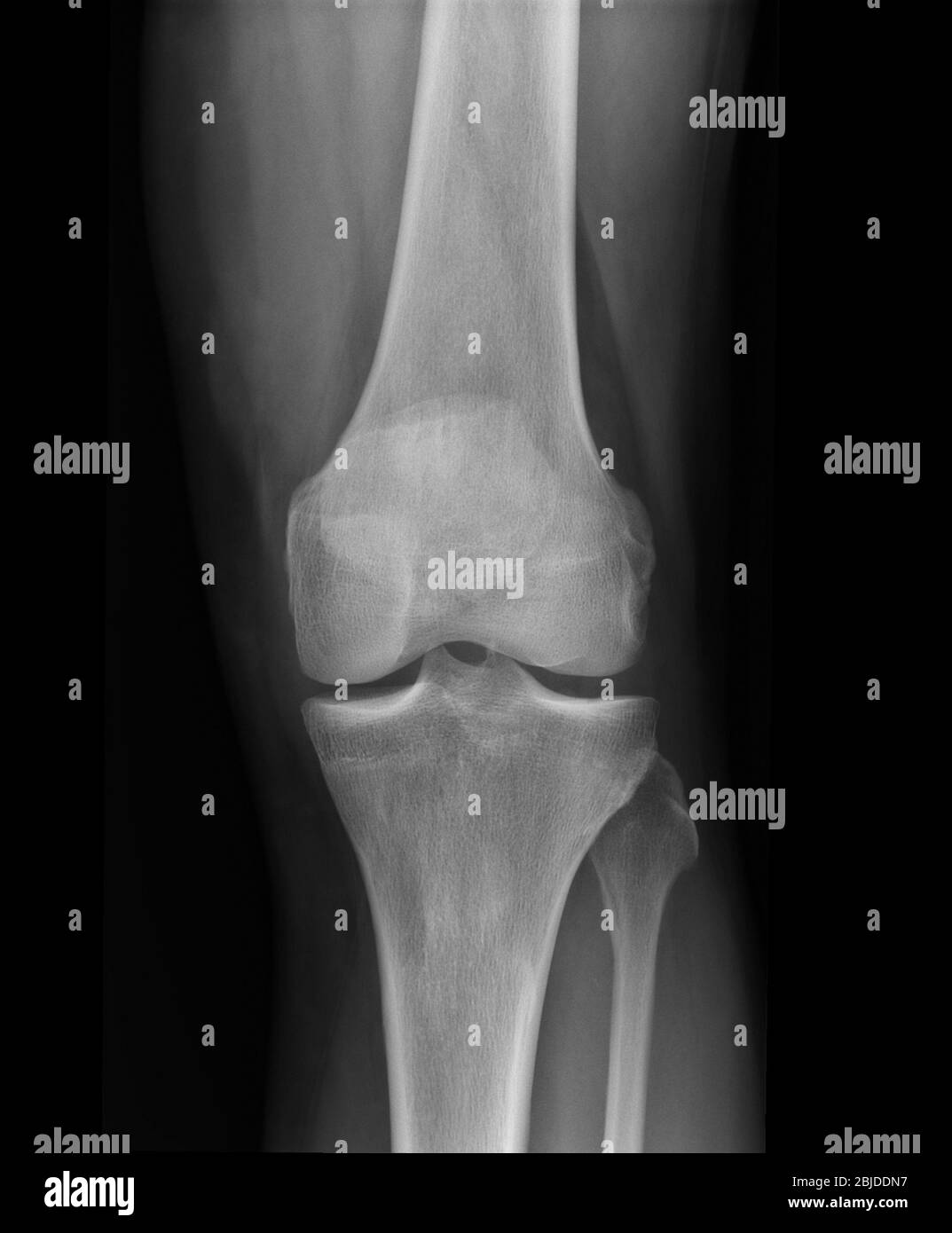 Knee anatomy hi-res stock photography and images - Alamy