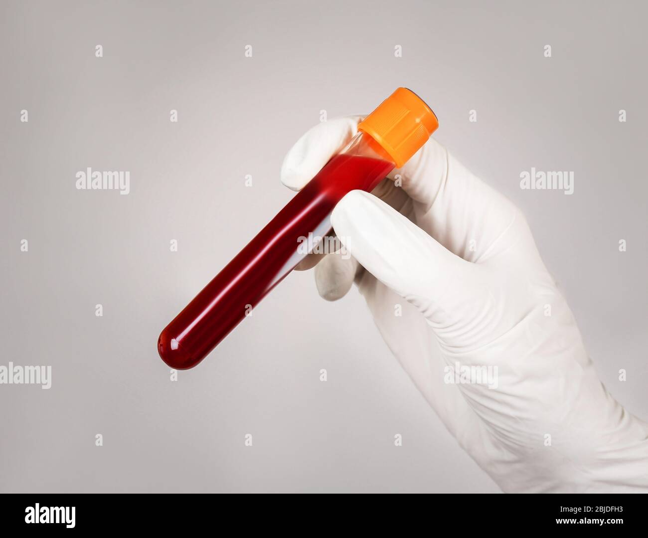 Hand of a doctor holding red blood in test tube on gray background ...