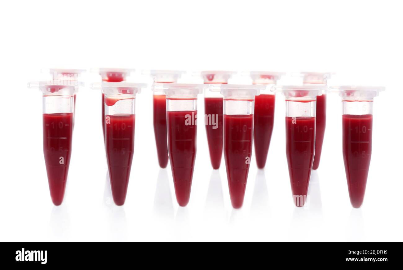 Test tubes filled with blood on white background Stock Photo - Alamy