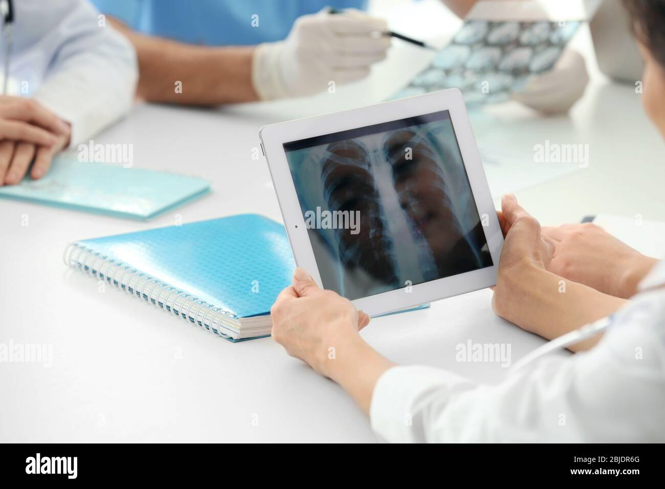 Young doctor exploring lung roentgenogram in clinic Stock Photo - Alamy