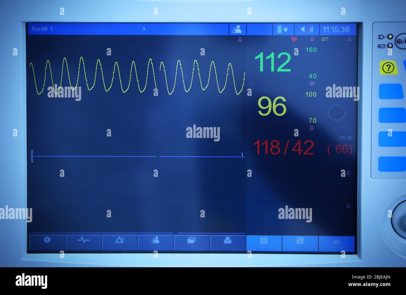 Cardiac monitor hi-res stock photography and images - Alamy