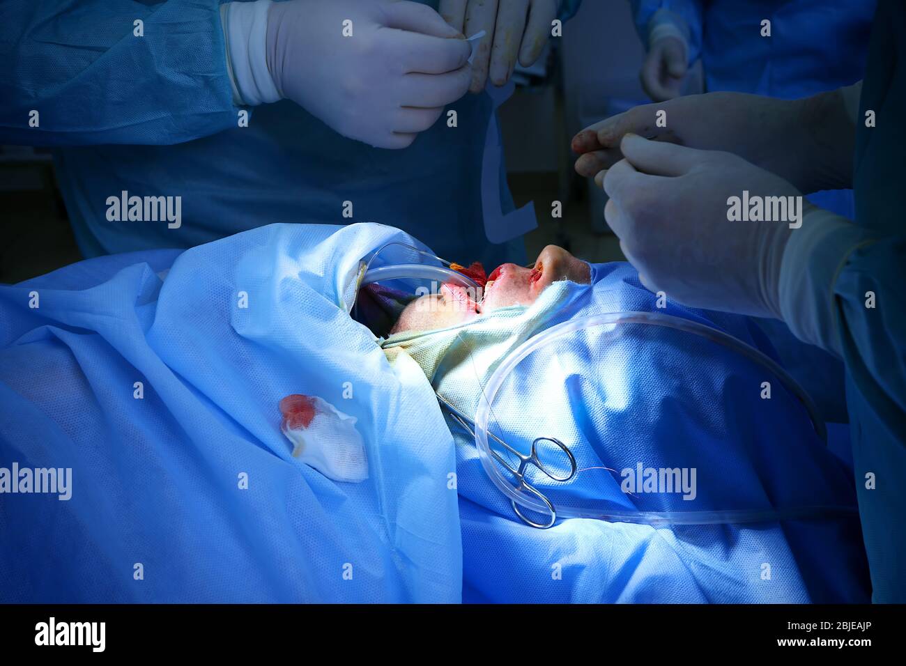 Cheiloplasty High Resolution Stock Photography and Images - Alamy