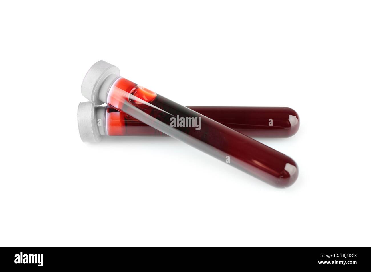 Test tubes with blood samples isolated on white Stock Photo - Alamy