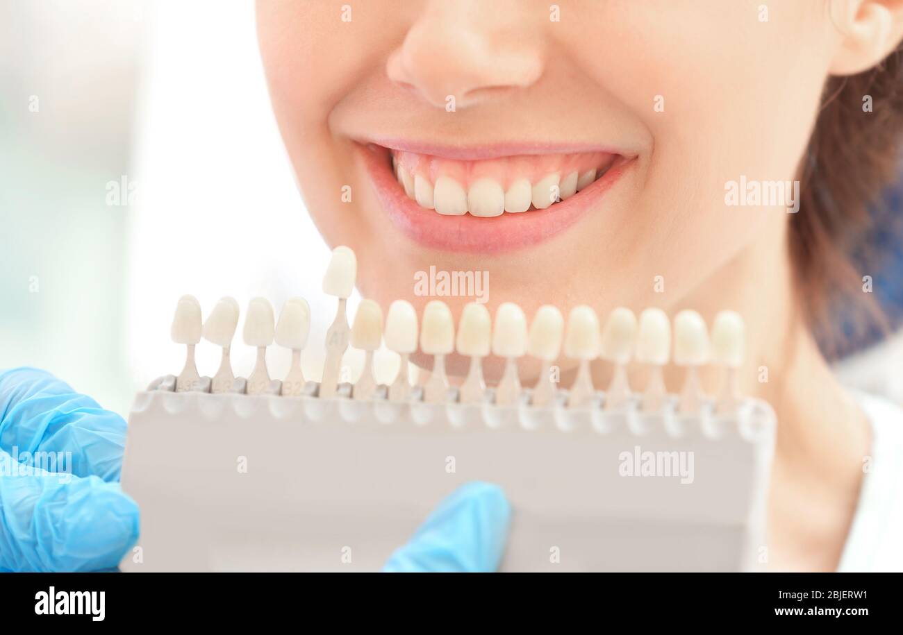 Dentist checking and selecting color of young woman's teeth Stock Photo ...