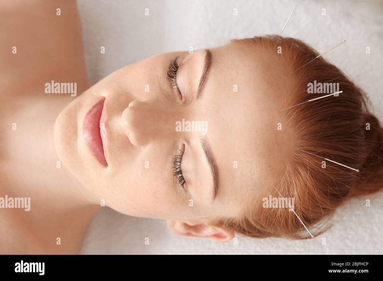 Therapy of female head with pricking acupuncture needles Stock Photo ...