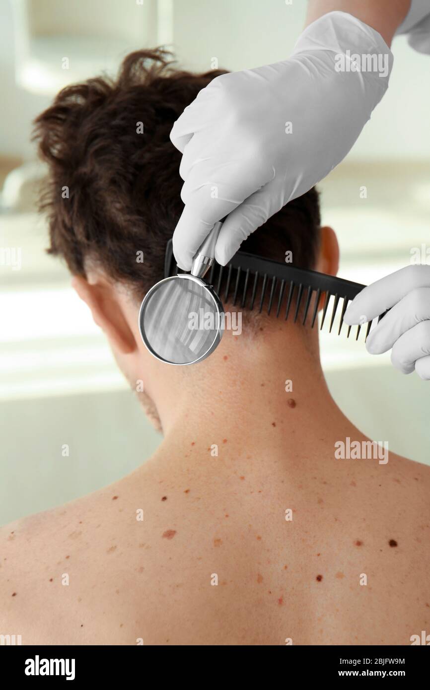 Dermatologist with magnifier examining patient in clinic Stock Photo ...