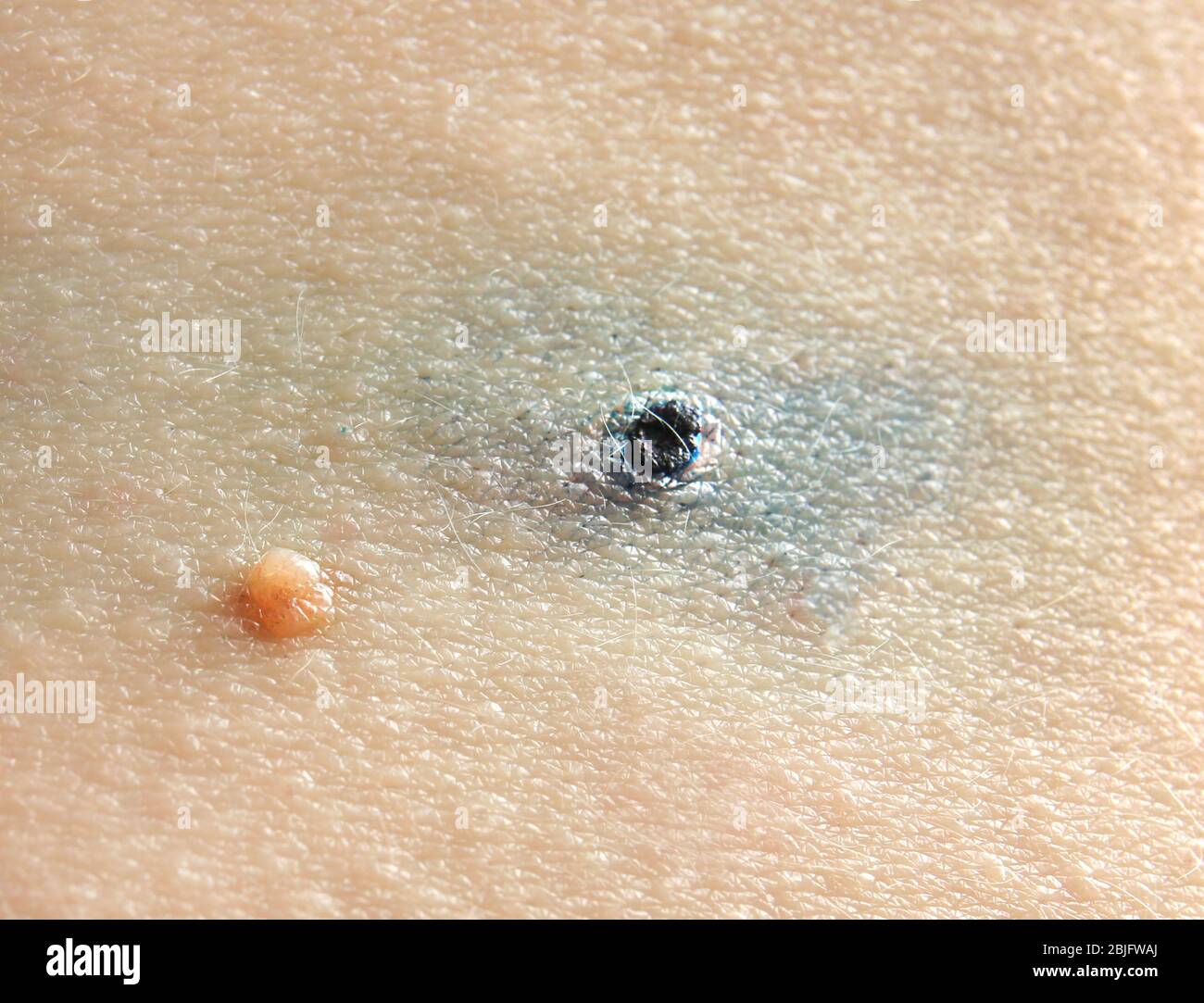 Methylene blue human hi-res stock photography and images - Alamy