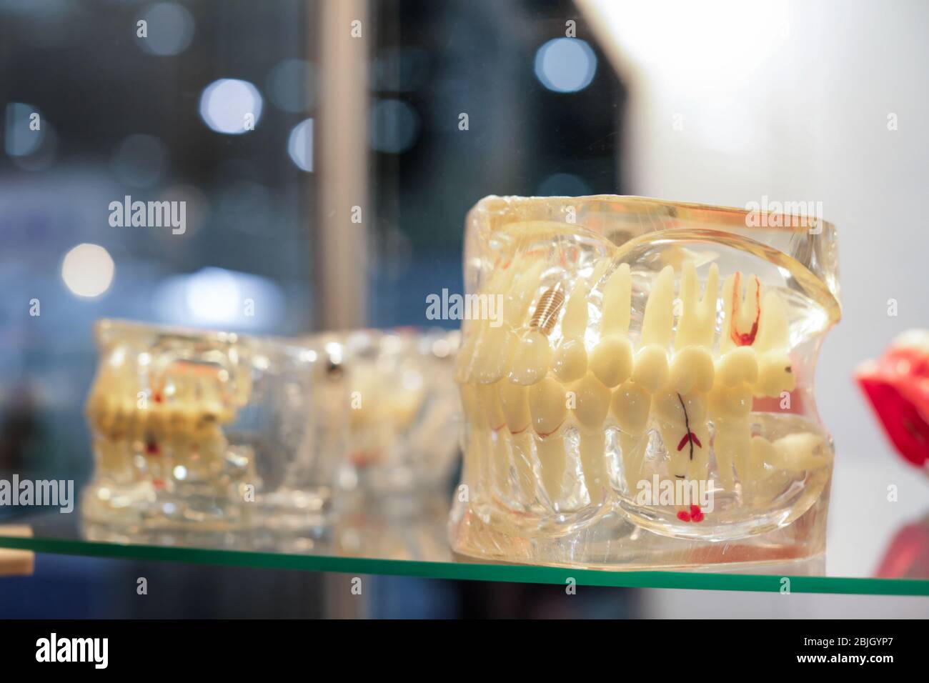 Dental jaw model on glass shelf Stock Photo - Alamy
